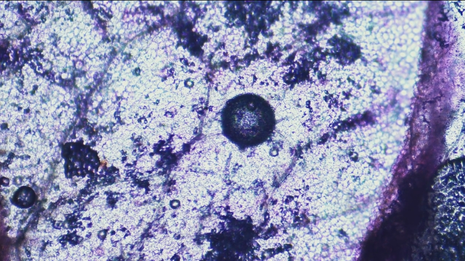 The Crucial Role of Inflammation in Exercise-Induced Reduction of ...