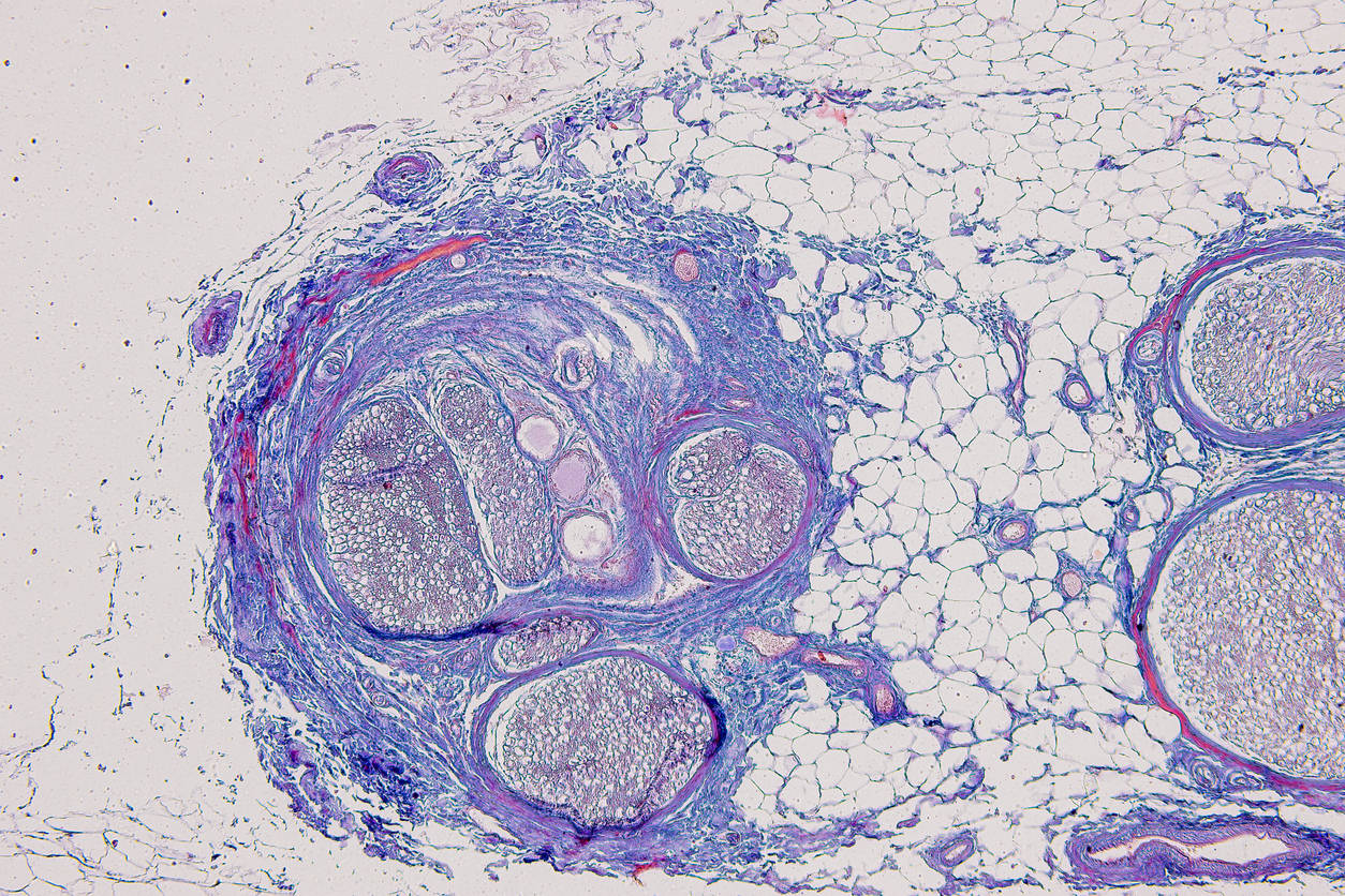 Rewiring the Brain’s Fullness Signal: Rapamycin’s Role in Leptin ...